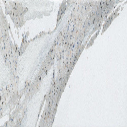 Emser Amala Cloud Glossy & Matte Porcelain Tile | Lowest Price — Stone ...